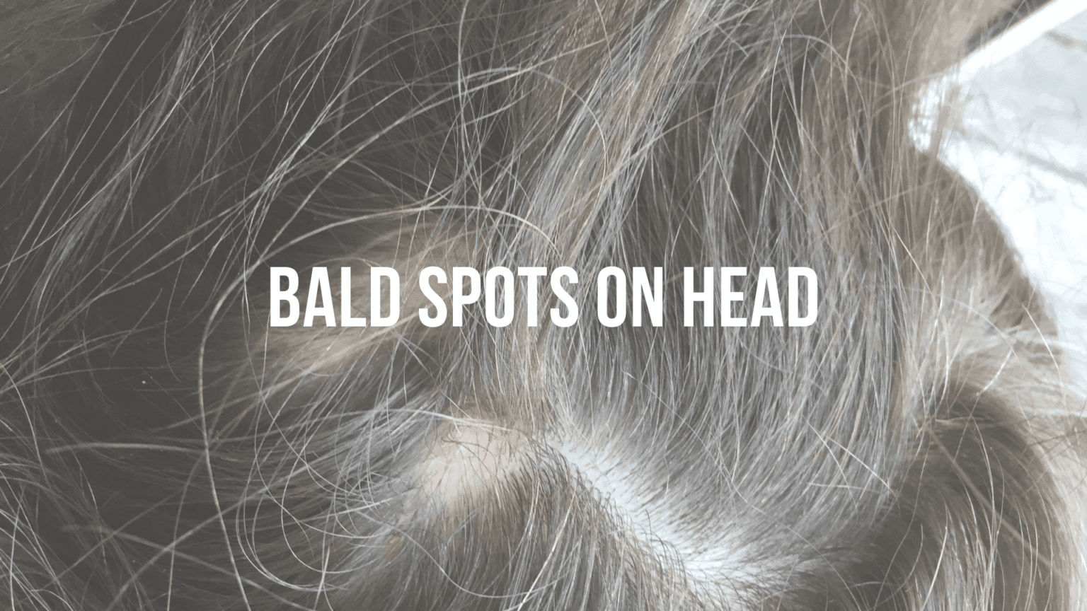Simple ways to Preventing a Shiny Bald Head - BALD LIFESTYLE