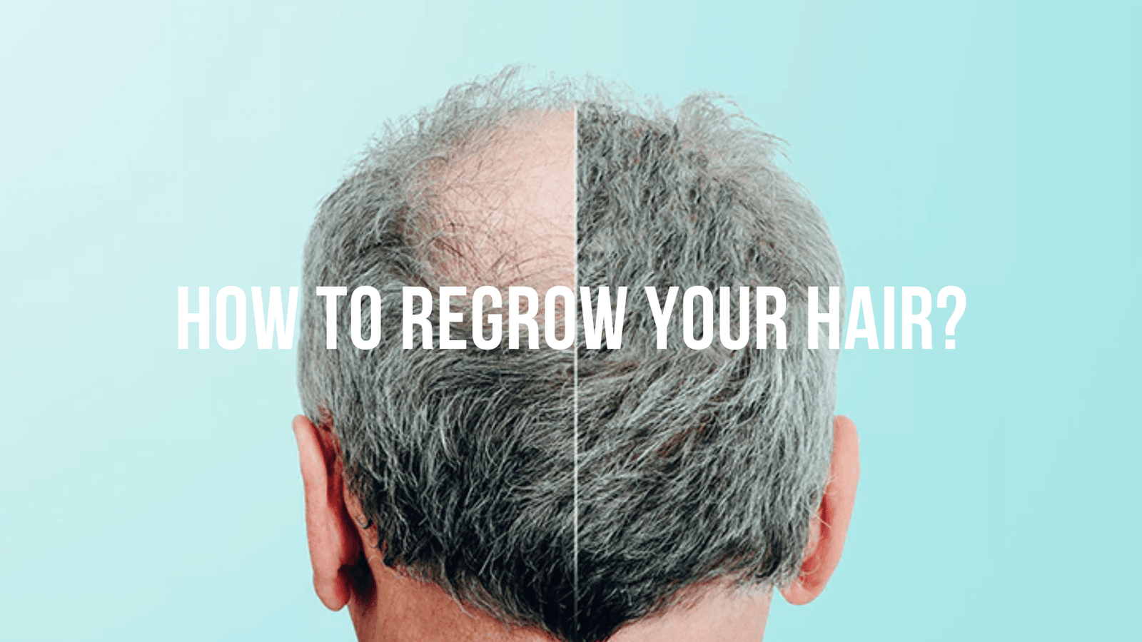 5 Efficient Ways To Regrow Your Hair Bald Lifestyle