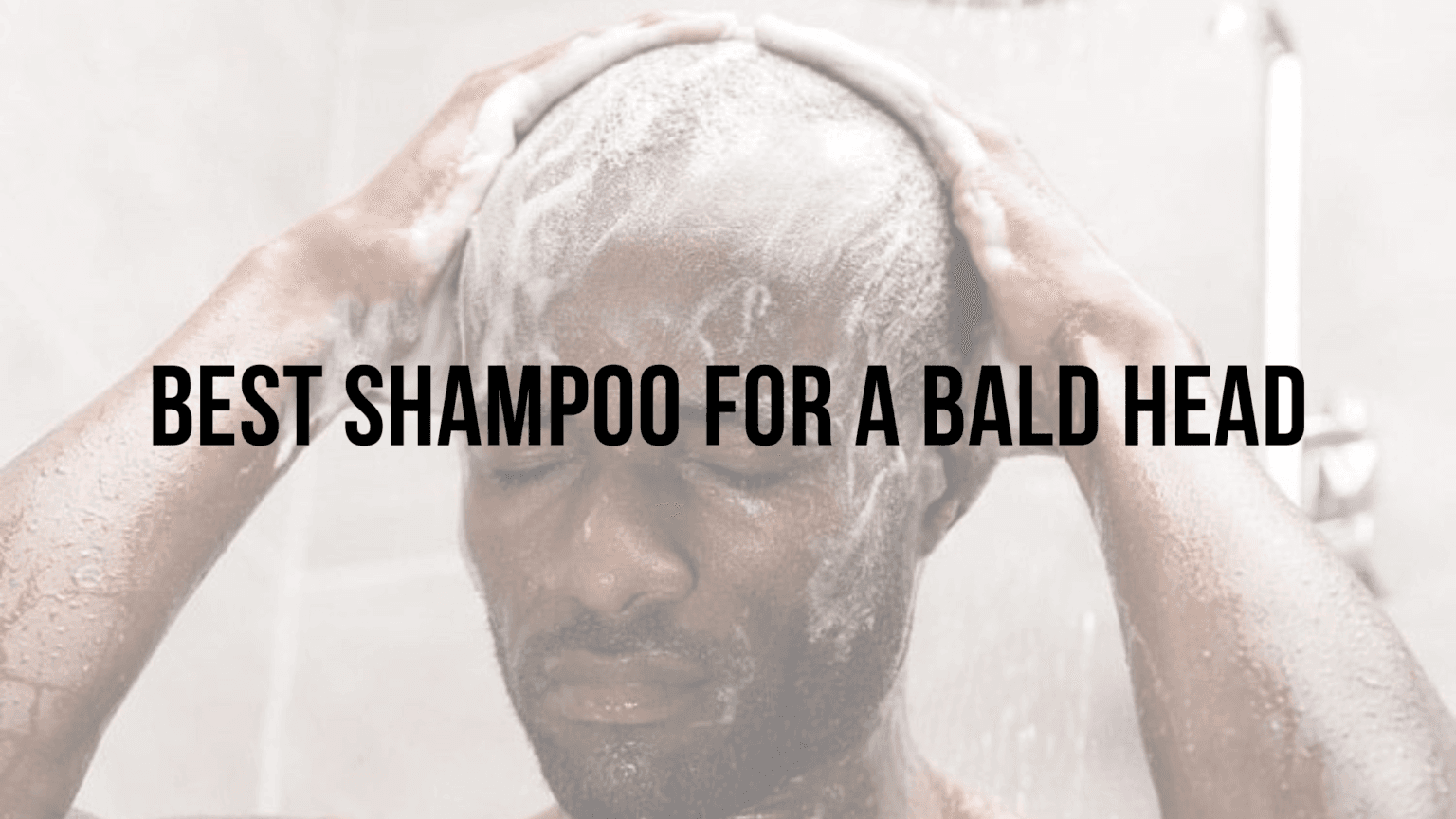 Understanding Vertex Baldness - BALD LIFESTYLE