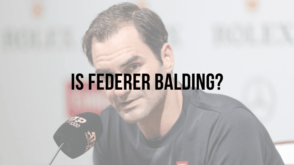 Is Justin Bieber balding? - BALD LIFESTYLE