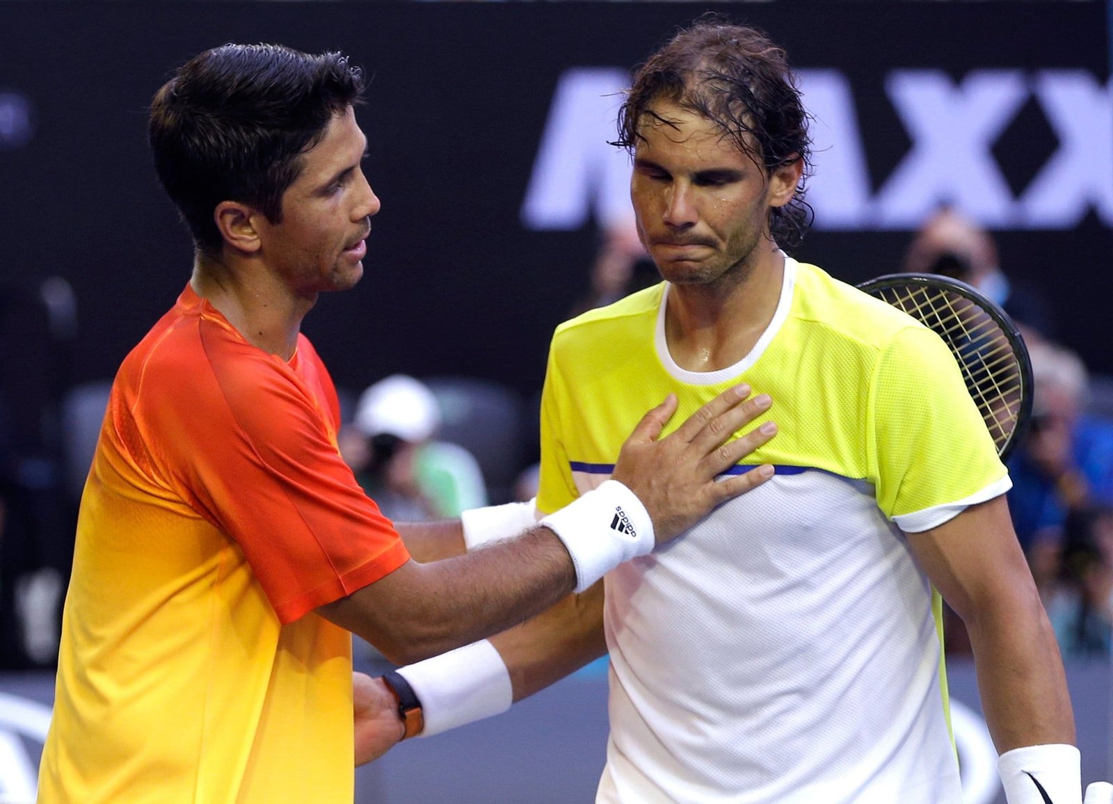 Exploring Rafael Nadal's Hair Journey - BALD LIFESTYLE